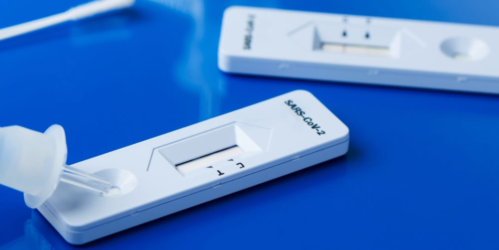 Test Kits in a Post-COVID-19 World: Navigating Their Evolving Efficacy
